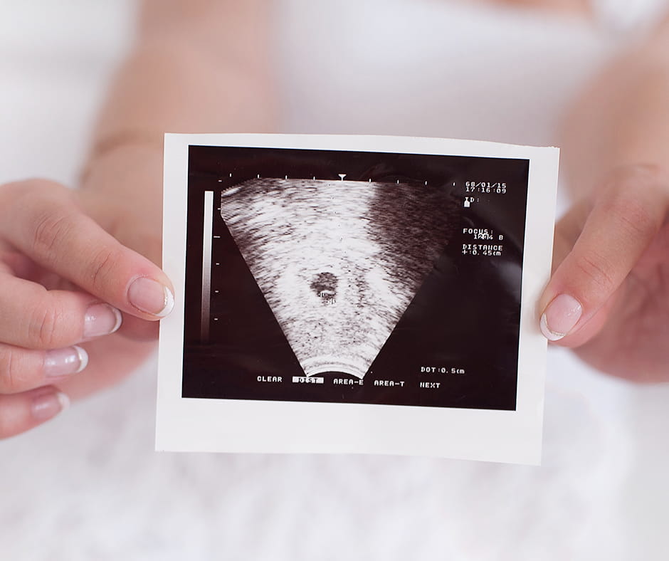 Benefits of PreNatal Orthopedic Consults | Arkansas Children's Blog